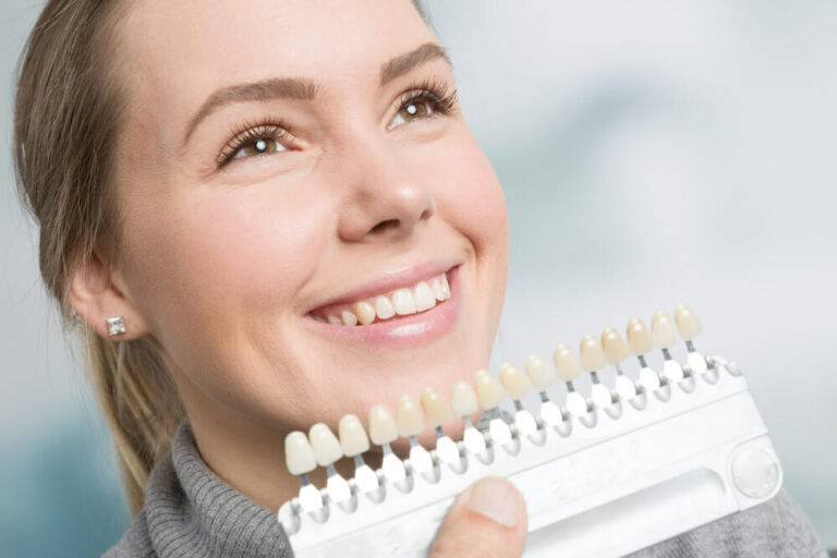 Composite Fillings in Sevenoaks[Request an appointment!]